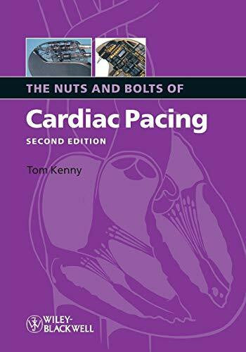 Kenny, Tom The Nuts and Bolts of Cardiac Pacing (Nuts and Bolts Series ...