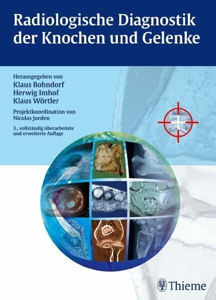 WÃ¶rtler, Klaus Radiologische Diagnostik der Knochen und Gelenke: Mit ...